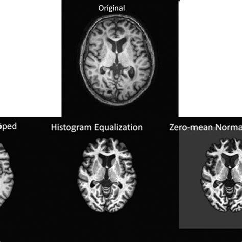 residual unet with dual attention—an ensemble residual unet with dual attention for multi‐modal