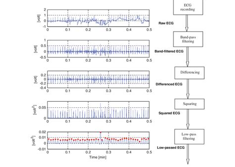 the four stages of the qrs detection algorithm along with corresponding download scientific
