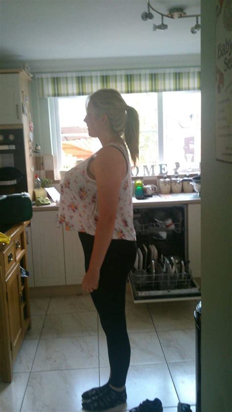Mum With 36K Breasts Needs To Raise 6k For Breast Reduction After
