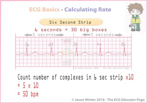 Quick Way To Calculate Rate On Ecg HOLLIE STRAKER