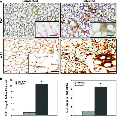 Macrophages In Adipose Tissue Immunohistochemical Analysis Using