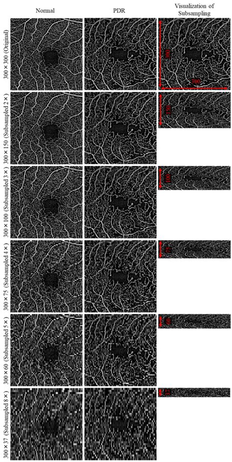 visualization of the effects of lateral subsampling across all factors download scientific