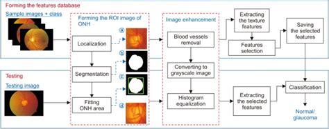 automatic glaucoma detection method applying a statistical approach to fundus images