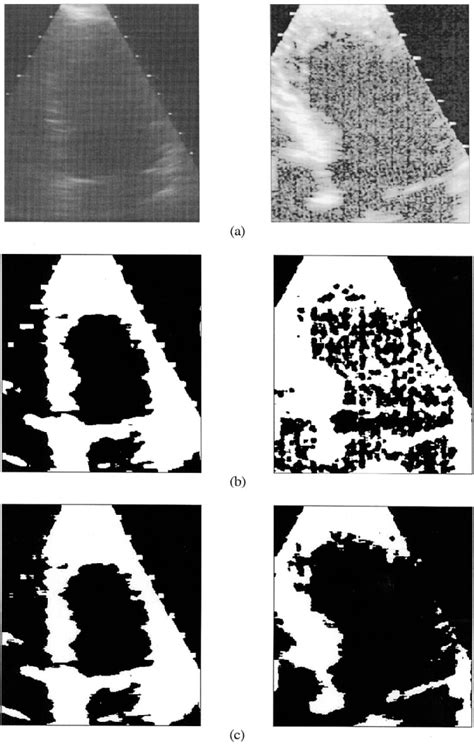 figure 1 from a new image segmentation method based on human brightness perception and foveal