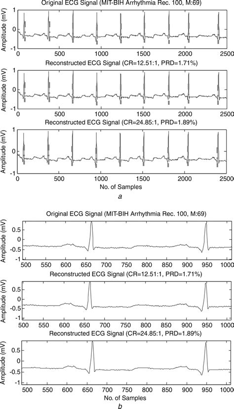 electrocardiogram signal compression using singular coefficient truncation and wavelet