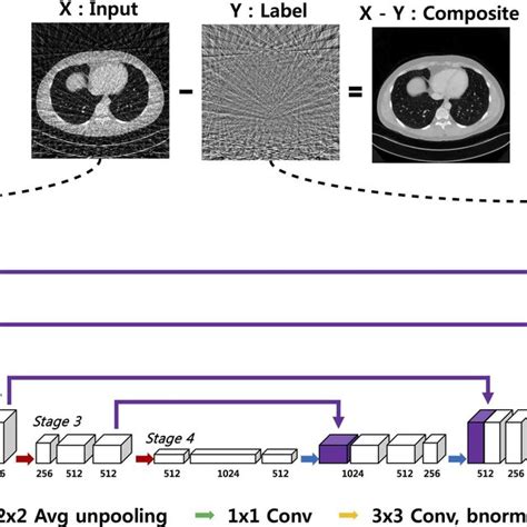 the proposed deep residual learning architecture for sparse view ct download scientific diagram