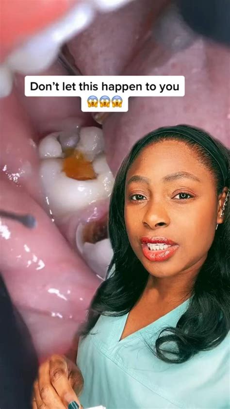 Dont Let This Happen To You Dental Videos Sensitive Teeth Oral Care Routine