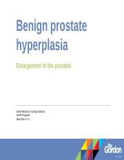 Understanding Benign Prostatic Hyperplasia And Treatment Options