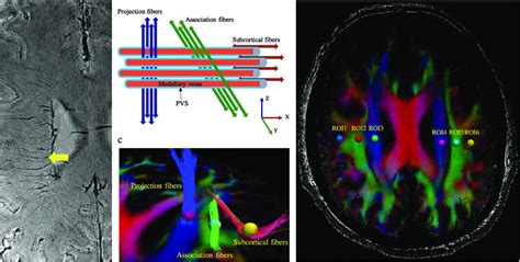 illustration of the diffusion tensor image analysis along the download scientific diagram