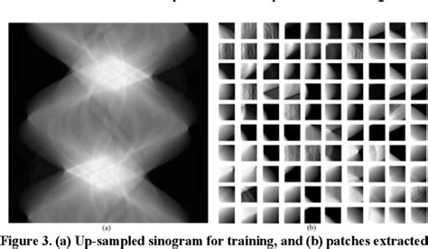 figure 3 from deep neural network based sinogram synthesis for sparse view ct image
