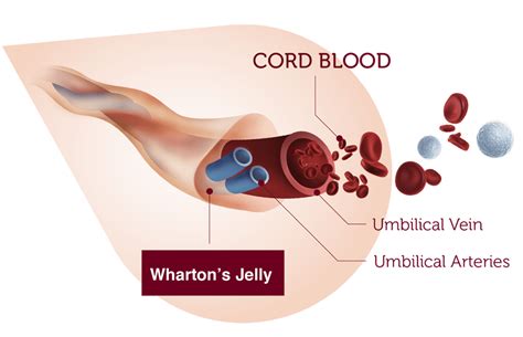 Wharton S Jelly Derived MSC Stem Cells Revolutionizing Healthcare And