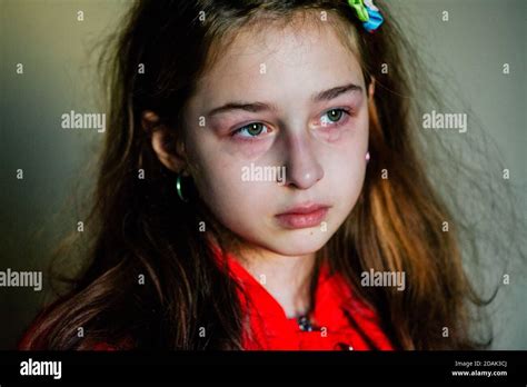 Little Sad Girl After Crying Crying Little Beautiful Girl With Sad Green Eyes And Frowning Face