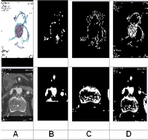 figure 4 from ct angiography image segmentation by mean shift algorithm and contour with