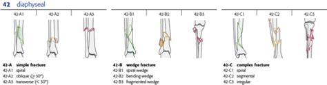 AO OTA Classification Of Tibial Diaphyseal Fractures 9 Download Scientific Diagram