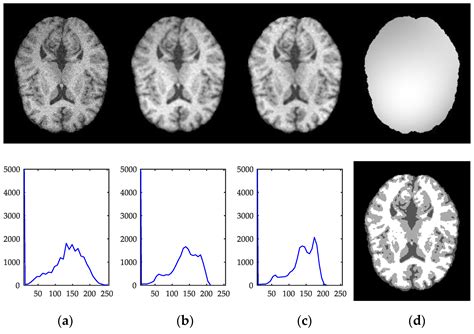 applied sciences free full text a robust brain mri segmentation and bias field correction