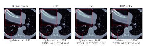 d reconstruction obtained with the filtered back projection fbp download scientific diagram