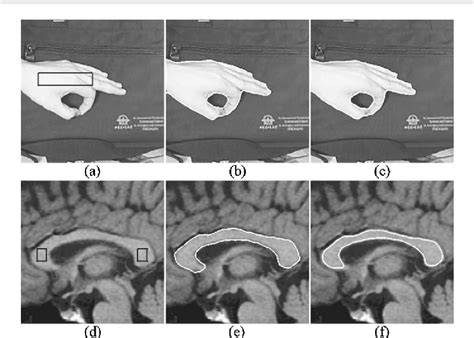 figure 1 from boundary based image segmentation using binary level set method semantic scholar