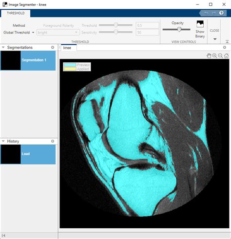 segment image using thresholding in image segmenter matlab and simulink mathworks deutschland