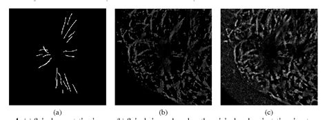 figure 4 from classification of linear structures in mammographic images semantic scholar