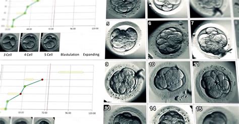 time lapse imaging embryoscope in london 2023