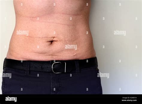 Pregnant Belly Button