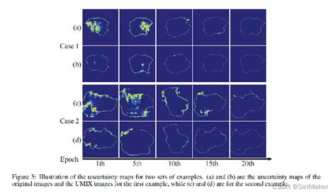 co training with high confidence pseudo labels for semi supervised medical image segmentation
