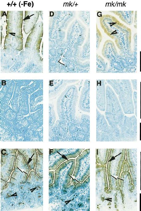 Immunohistochemical Staining Of DMT1 In The Intestine Of Anemic Mk Mk