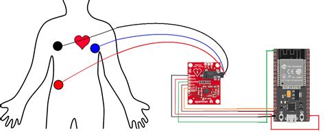 Iot Based ECG Monitoring With AD8232 ECG Sensor And ESP32 On Ubidots