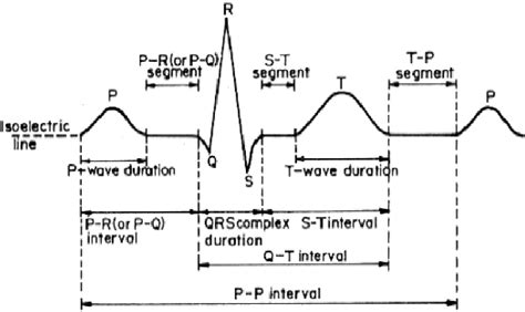 [pdf] a unified approach of ecg signal analysis semantic scholar