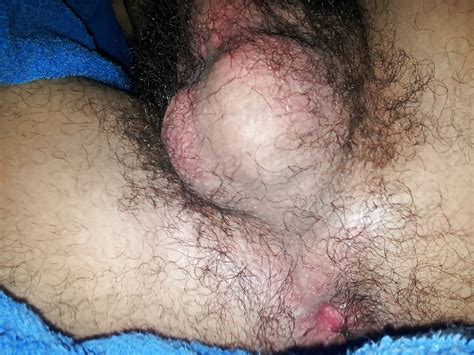 Pubic Hairy Porn Pictures Xxx Photos Sex Images 1929501 Pictoa