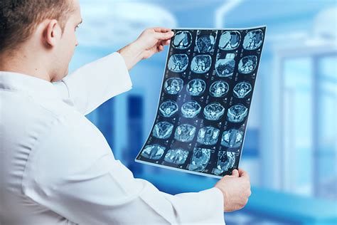 how radiology transcription supports structured reporting