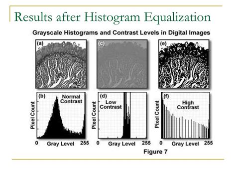 histogram equalization