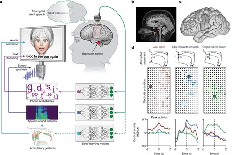 brain computer interface enables woman with severe paralysis to speak through digital avatar