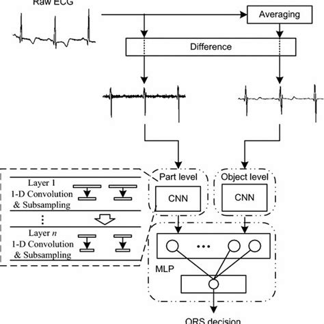 overview of the proposed qrs complex detection method download scientific diagram