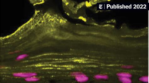 Scientists Have Designed A ‘vagina On A Chip The New York Times