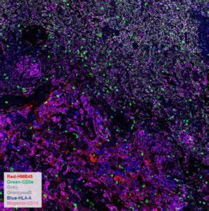 Spatial Multiomics The Need For Multidimensional Analysis With Single