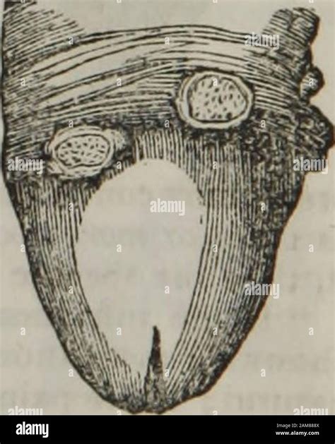 Male Genital System Fotos Und Bildmaterial In Hoher Auflösung Alamy