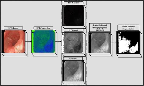 active contour segmentation in hsi color space download scientific diagram