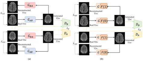 diagnostics free full text multi contrast mri image synthesis using switchable cycle