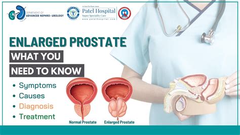 𝐄𝐧𝐥𝐚𝐫𝐠𝐞𝐝 𝐏𝐫𝐨𝐬𝐭𝐚𝐭𝐞 Bph Symptoms Causes Diagnosis Treatment Prostate Health Patel