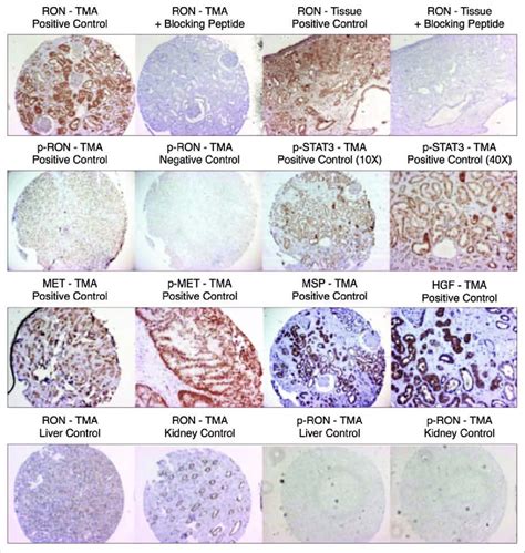 Tissue Immunohistochemistry Controls Tissue Microarray TMA Of