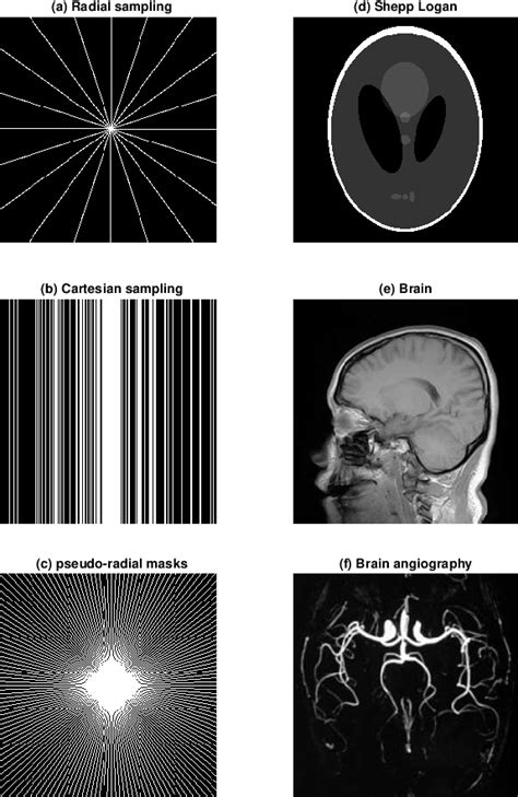figure 2 from a symmetric admm for non convex regularization magnetic resonance imaging