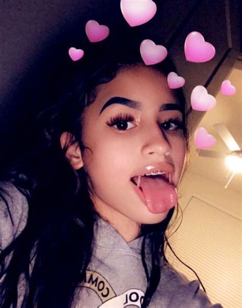 Pin Iamsunny00👑 Cute Braces Cute Girls With Braces Braces Girls