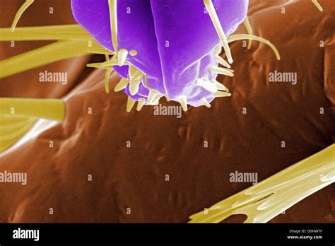 This Highly Magnified Digitally Colorized Scanning Electron Micrograph