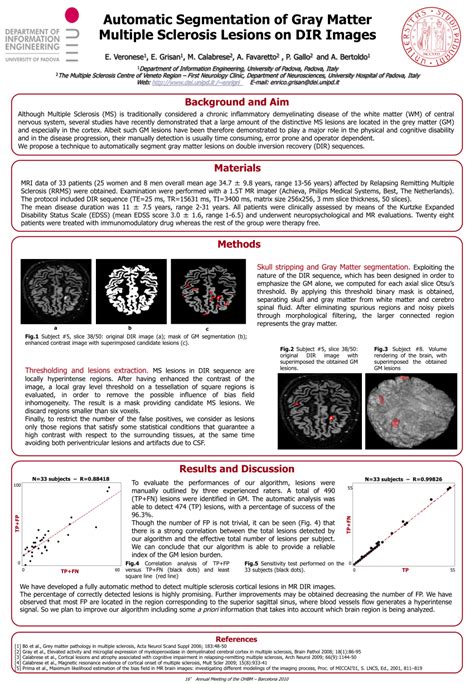 pdf automatic segmentation of gray matter multiple sclerosis lesions on dir images