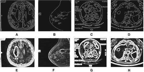 edge detection algorithms for boundary detection in medical images download scientific diagram