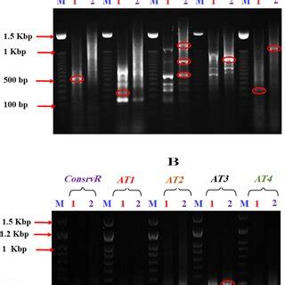 Differential Display Dd Pcr Using Different Primers As Arbitrary
