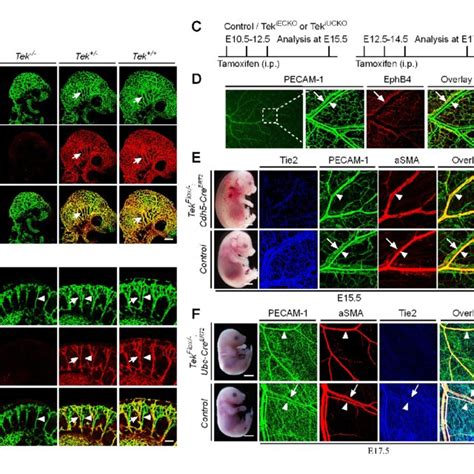 Tie2 Attenuation Leads To Vascular Tuft Formation Along Retinal Veins