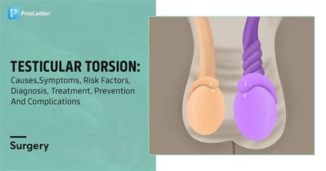 Testicular Torsion Causes Symptoms Risk Factors Diagnosis Treatment Prevention And