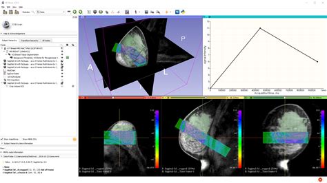 how to properly rotate a dicom 2 by lassoan support vtk